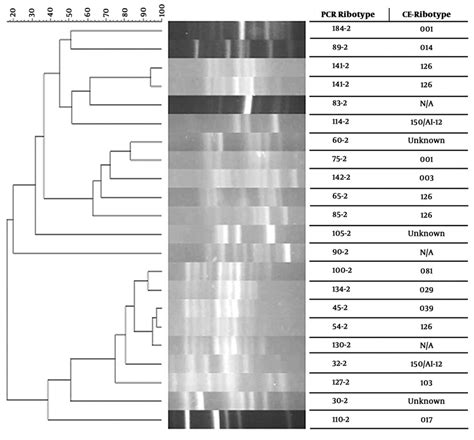 Comparison Of Pcr Ribotypes Of C Difficile Isolates From Patients Download Scientific Diagram
