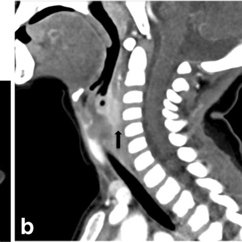 A Schematic Diagram Depicts The More Typical Surgical Anatomy Of The Download Scientific