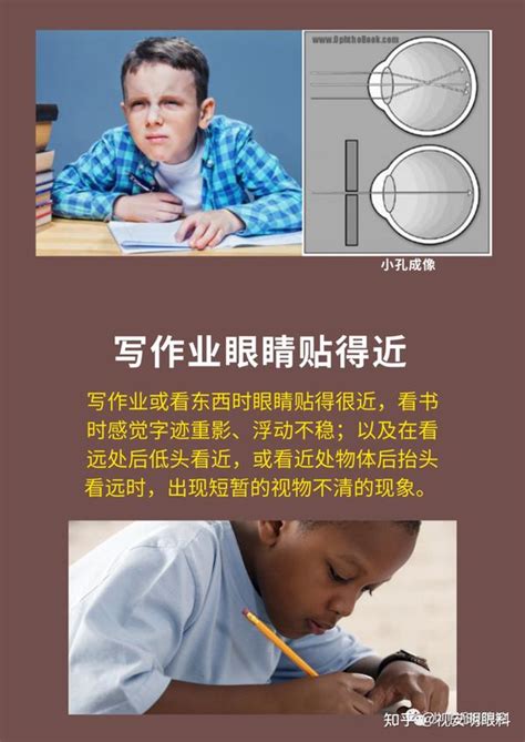 家长须知孩子近视眼的表现和分类 知乎