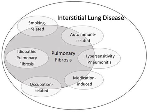 Interstitial Lung Disease And Pulmonary Fibrosis A Practical Approach