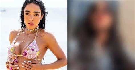 Manelyk Gonz Lez Muestra C Mo Luce Su Rostro Tras Un Mal Tratamiento Est Tico Que Pudo Dejarla