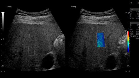 Logiq E10 Certified Medical Equipment And Supplies