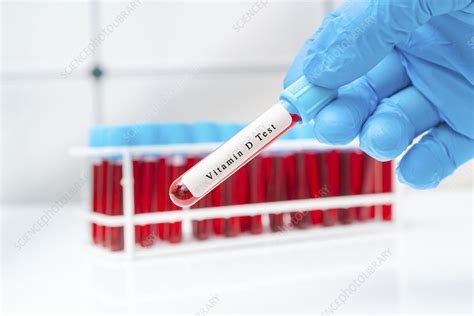 Vitamin D Blood Test Conceptual Image Stock Image F032 7110 Science Photo Library