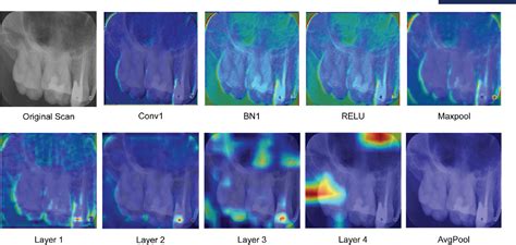 Figure 1 From Visualization Of Layers Within A Convolutional Neural