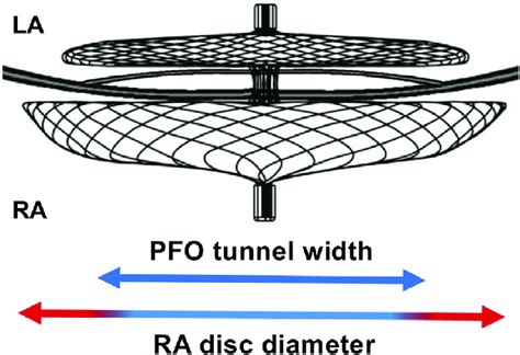 Pfo Sizing And Device Size Selection Schematic Based On Tunnel Width