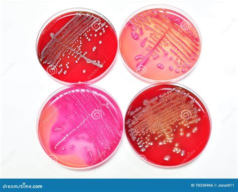 Acinetobacter On Blood Agar