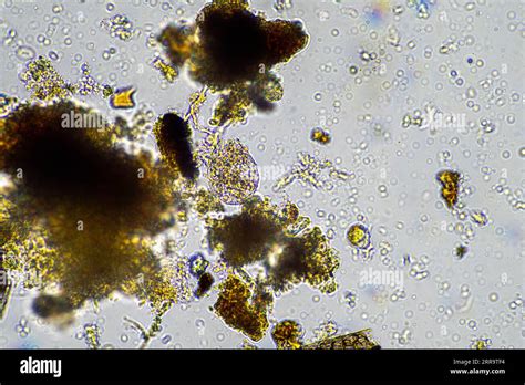 Microbial Organisms Under The Microscope In A Lab In America Stock Photo Alamy