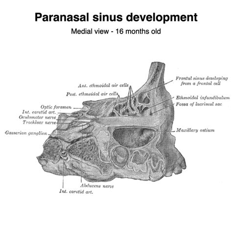 Antrum Maxillary