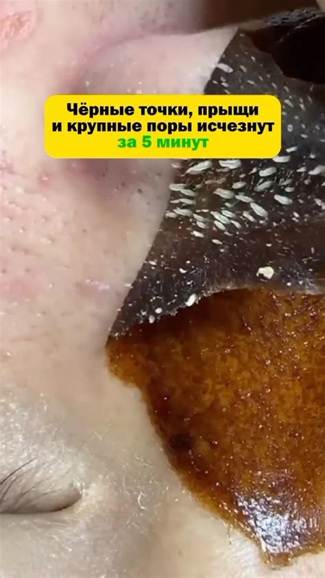 Я столкнулась с анемией и послеоперационным периодом Волосы ушли появились проплешины и на