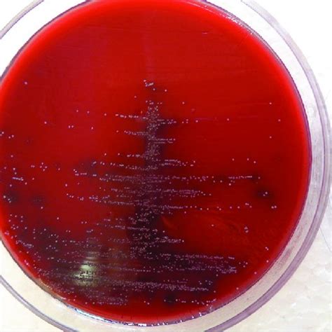 Turbidity Implying The Growth Of Bacteria Download Scientific Diagram
