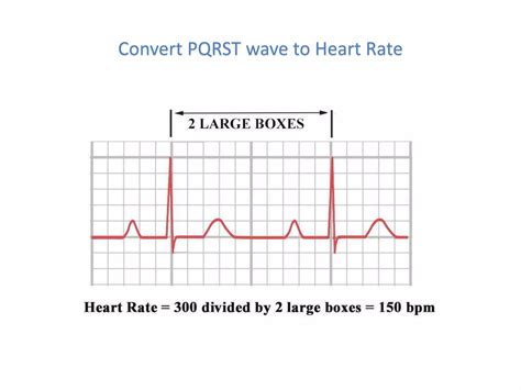 Efficient Vlsi Architecture For Data Analysis Of Ecg Ppt Pregnancy Reproductive Health