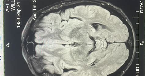 Are These Lesions FindATopDoc