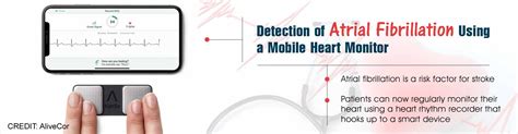 Smartphone Monitoring System Detects Atrial Fibrillation With Excellent