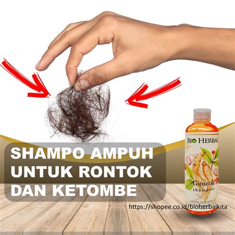 Jual Sampo Anti Rontok Vitamin Perawatan Rambut Rontok Parah Penumbuh Penyubur Rambut Rusak