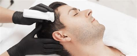 Scalp Microneedling With Bonus LED Therapy Aesthetic