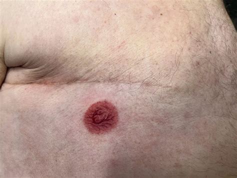 I Had My Nipple Replaced By A 3d Tattoo And Finally Feel Complete