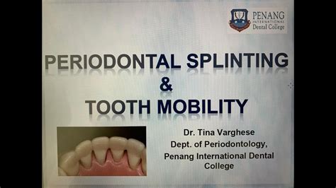 Types Of Splinting In Dentistry At Mildred Tobin Blog