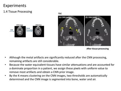 Convolutional Neural Network Based Metal Artifact Reduction In X Ray