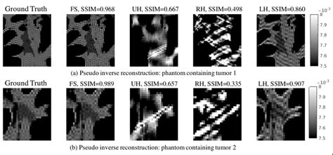 Rois From Images Reconstructed By Use Of The Pseudoinverse