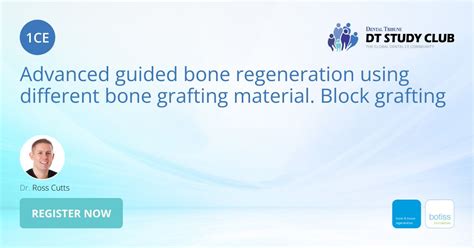 Advanced Guided Bone Regeneration Using Different Bone Grafting Material Block Grafting