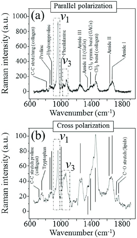Representative Raman Spectra Of Cortical Bone Sample In Figure 1 In