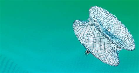 Amplatzer Ventricular Septal Defect Occluder Vsd Closure