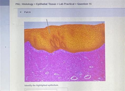 Solved Pal Histology Epithelial Tissue Lab Practical