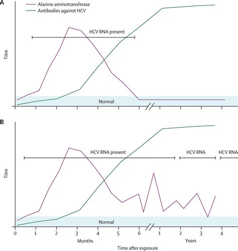 Acute Hepatitis C The Lancet