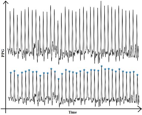 Original Ppg Signal Top Ppg Signal With Detected Peaks Bottom