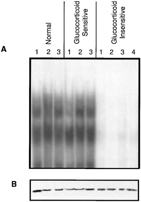 Gcr Binding To Specific Consensus Double Stranded Dna Binding Sequences Download Scientific