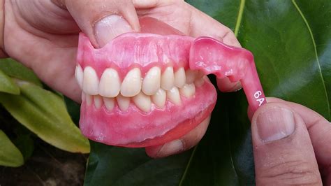 Labs Cilso Próteses Dentárias Gessos Do Tipo 1 São Compostos De