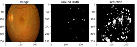 u net can t perfectly segment image page 2 vision pytorch forums