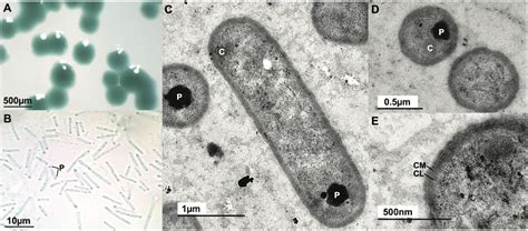 Thylakoid Cyanobacteria