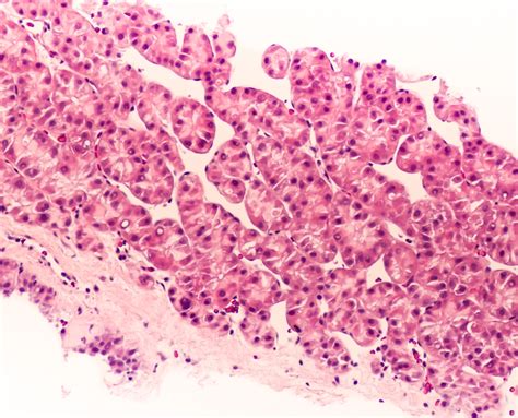 Gentest® Human Liver Microsomes Discovery Life Sciences