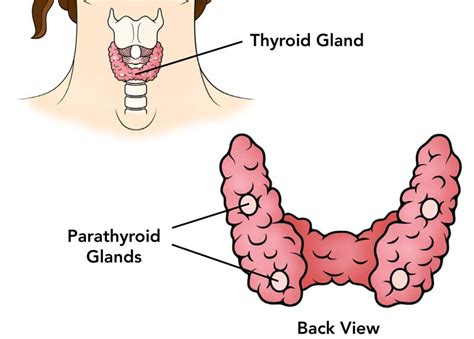 Parathyroid Disorders Thyroid Sydney