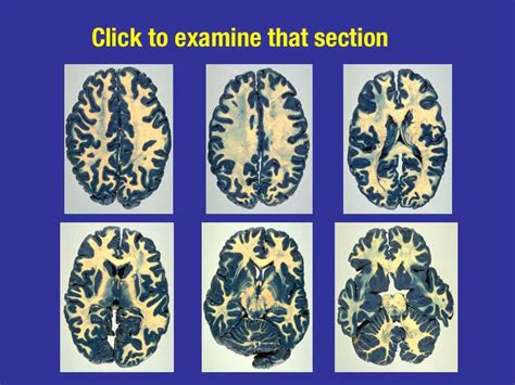 Atlas Of Axial Brain Slices