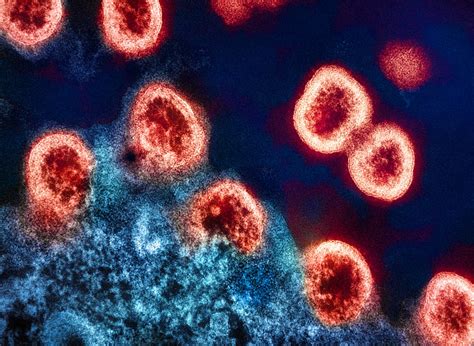 Infeksi Saluran Reproduksi Dan Hiv Aids