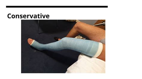 Tibia Fracture Classification And Management Pptx
