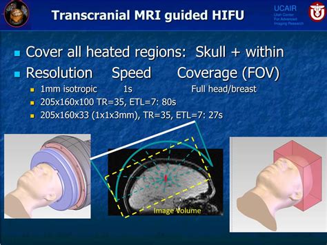 Ppt Improved Mri Temperature Imaging Using A Subject Specific Biophysical Model Powerpoint