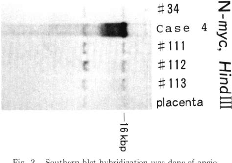 Figure 2 From Amplification Of N Myc Gene And Increase Of Urinary Vma And Hva In Patients With