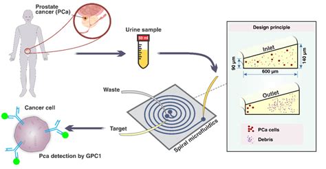 A Schematic Representation Of The Workflow For PCa Cell Detection From Download Scientific