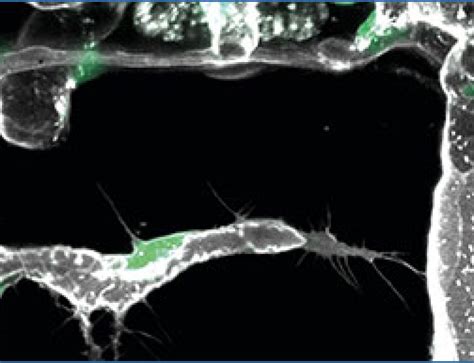 Comparison Of Atopic Dermatitis Transcriptome Profiling By Microarray And Rna Seq Rna Seq Blog