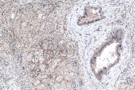 Ihceasy Mct4 Ready To Use Ihc Kit Khc0133 Proteintech 武汉三鹰生物技术有限公司