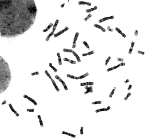 Example Metaphase Images Unlock Advanced Insights — Smarttype