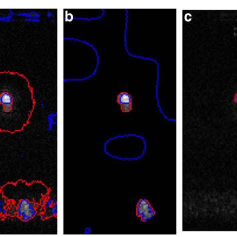 Inaccurate Curve Evolution By Li Et Al S [31] Method With Background Download Scientific