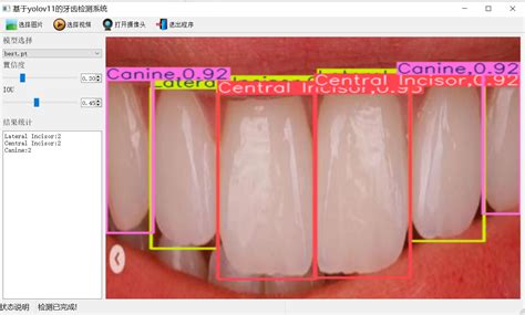 基于yolov11的牙齿检测系统python源码pytorch模型评估指标曲线精美gui界面基于yolov11的牙齿健康检测模型设计 Csdn博客