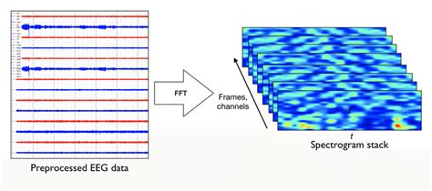generation of spectrogram stack for a subject from preprocessed
