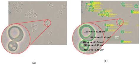 Tim Faith On Linkedin Yeast Morphology Assessment Through Automated Image Analysis During