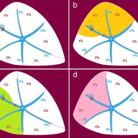 Schematic Diagram Of Extended Segmentectomy And Combined Download Scientific Diagram