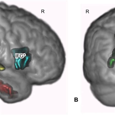 Primary Sensory Higher Order Sensory Processing And Cognitive Download Scientific Diagram